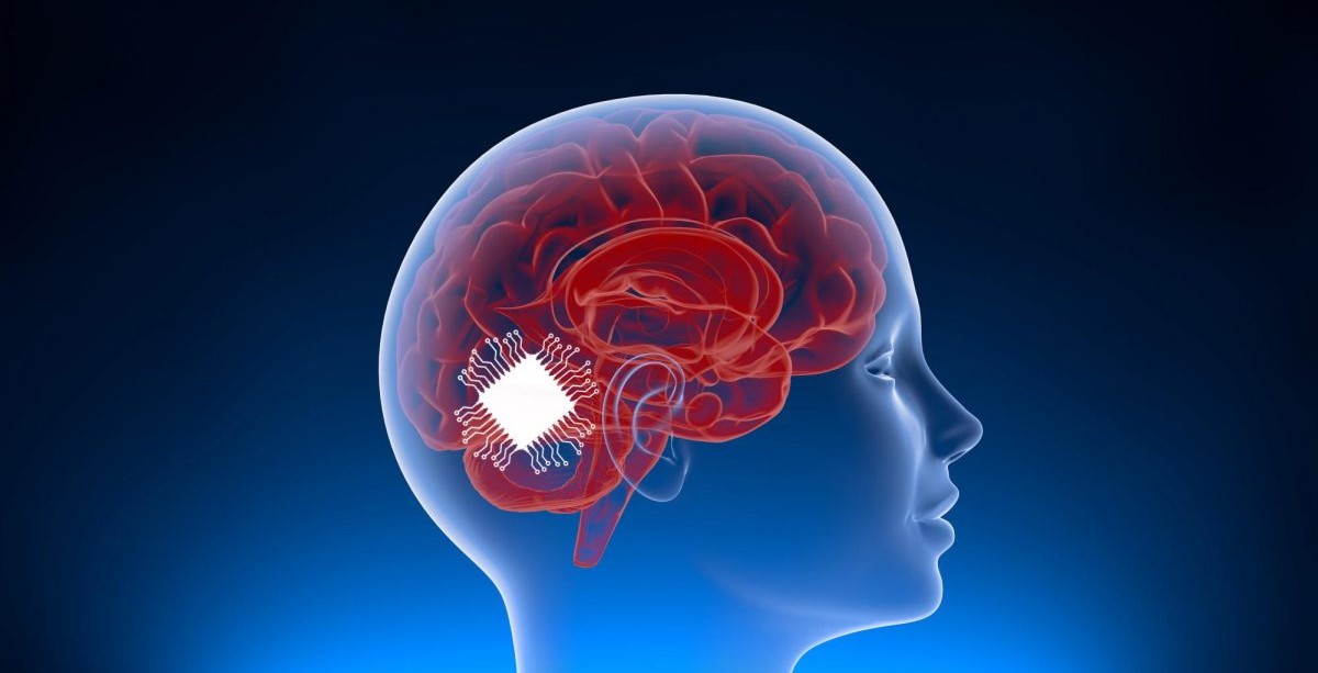 Neuralink: malfunzionamento del primo chip cerebrale impiantato su un umano